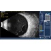 B-Scan Plus - Ophthalmic Ultrasound Equipment