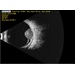 B-Scan Plus - Ophthalmic Ultrasound Equipment