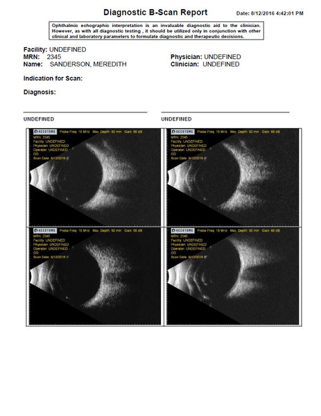 B-Scan Plus - Ophthalmic Ultrasound Equipment
